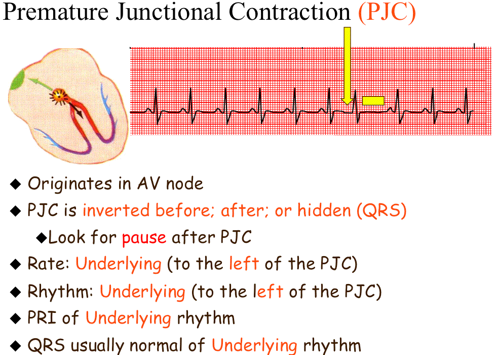 PJC